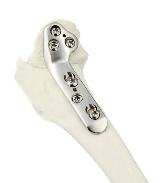 Top 10 TPLO Surgeons in California